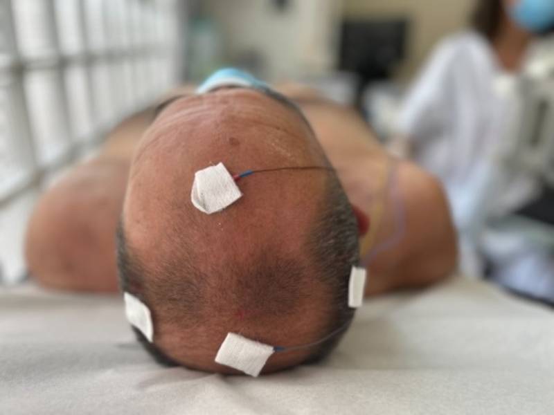 Potenciales Evocados Somestésicos O Somatosensoriales Pess Hospital